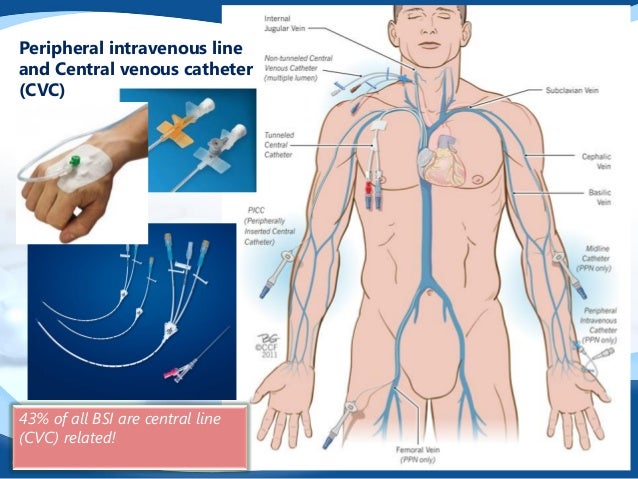 Healthcare associated infections and eskape pathogens