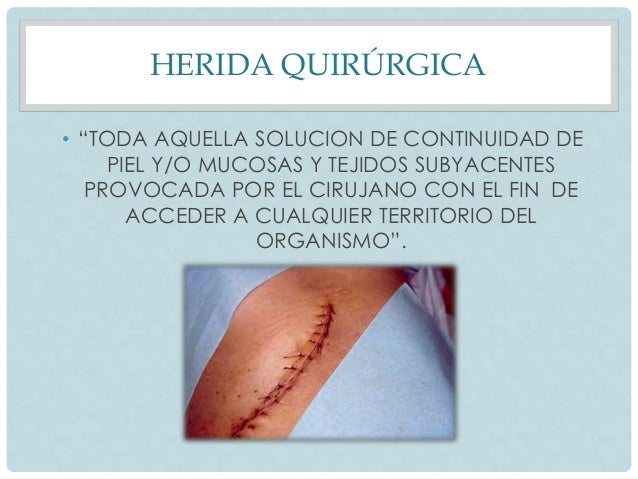 Herida quirúrgica e infectada