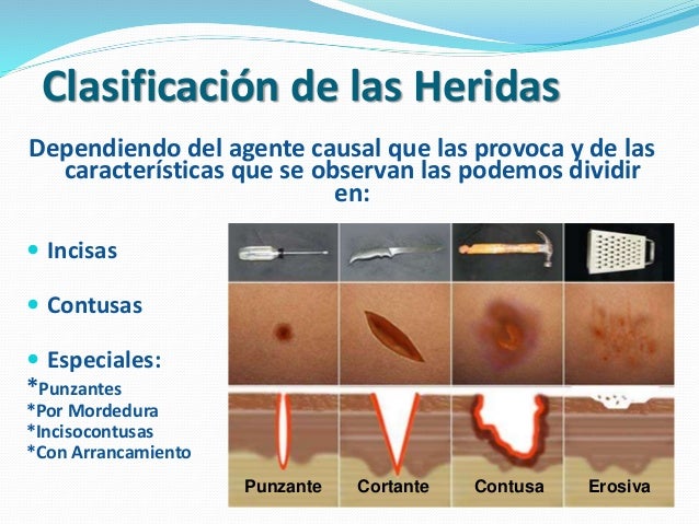 Heridas, clasificación y primeros auxilios en cada caso