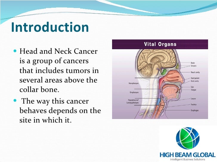 Head And Neck Cancer