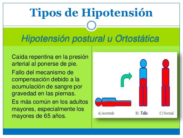 Hipotension Shock