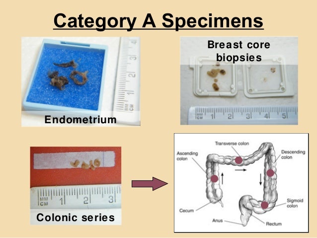 Histopathology In Practice - Sample Reception, Dissection, Processing…