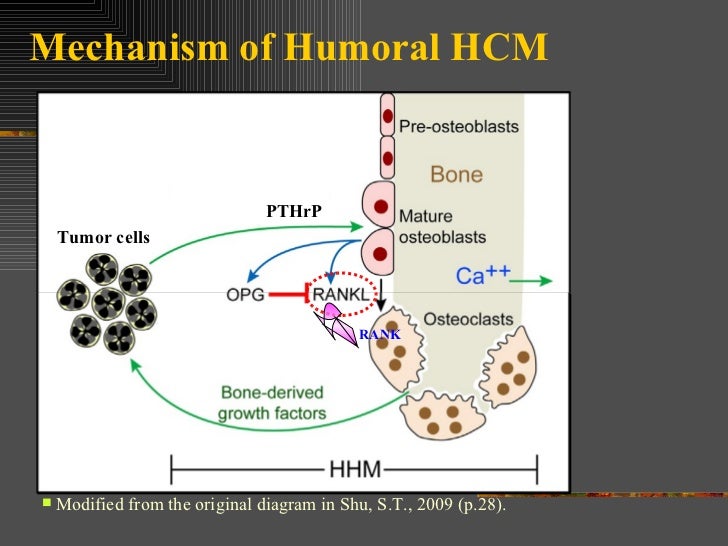 Hypercalcemia of malignancy
