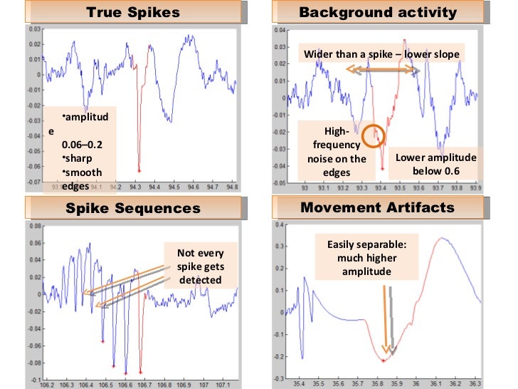 Spike Detect Matlab