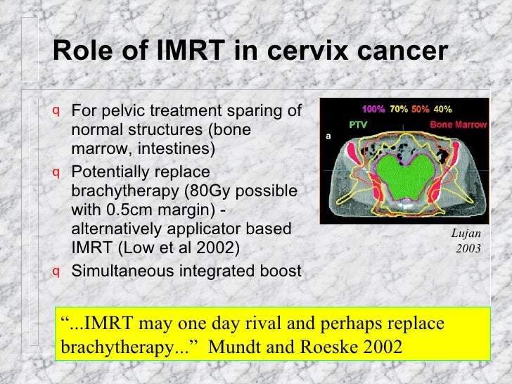 Imrt In Cervix Cancer