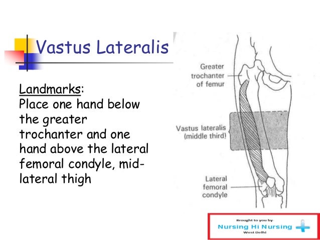 Vastus Lateralis Infant PPT Intramuscular Injection PowerPoint