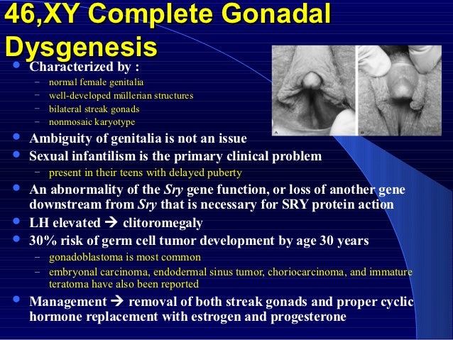 Intersex Ppt By Arch