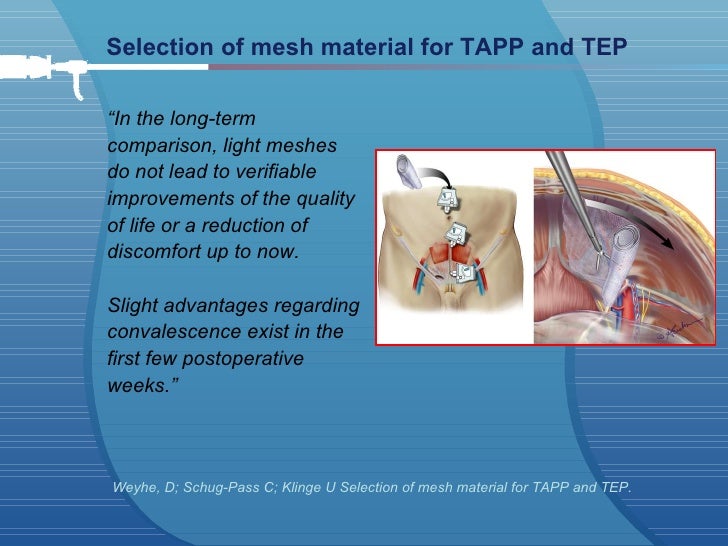 Laparoscopic Inguinal Hernia Repair Eminence-based or Evidence-based?