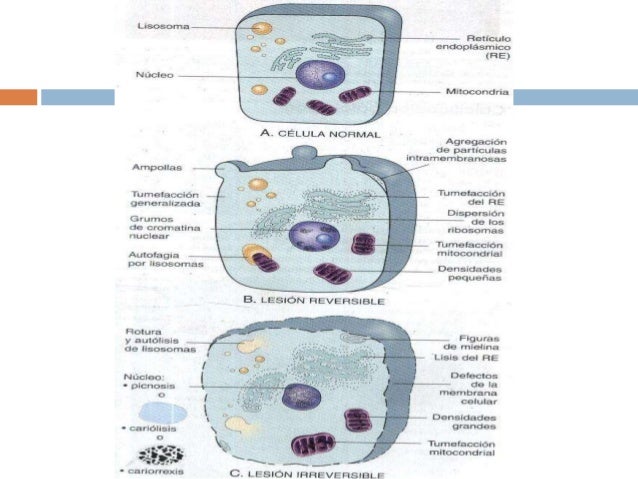 Lesion celular reversible e irreversible
