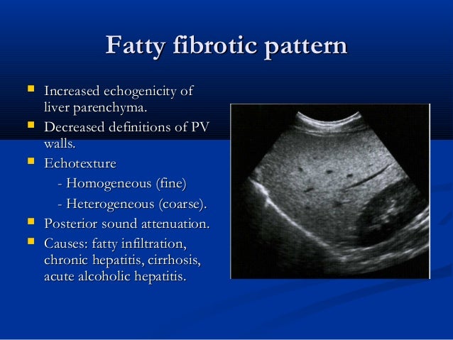 Liver Ultrasound