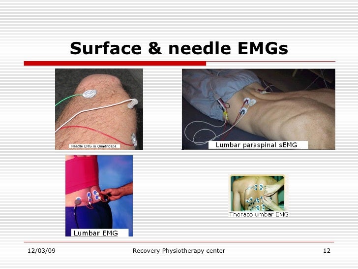 Lumbar Spine Emg