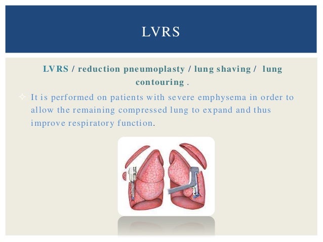 Lung volume reduction surgery ( LVRS )