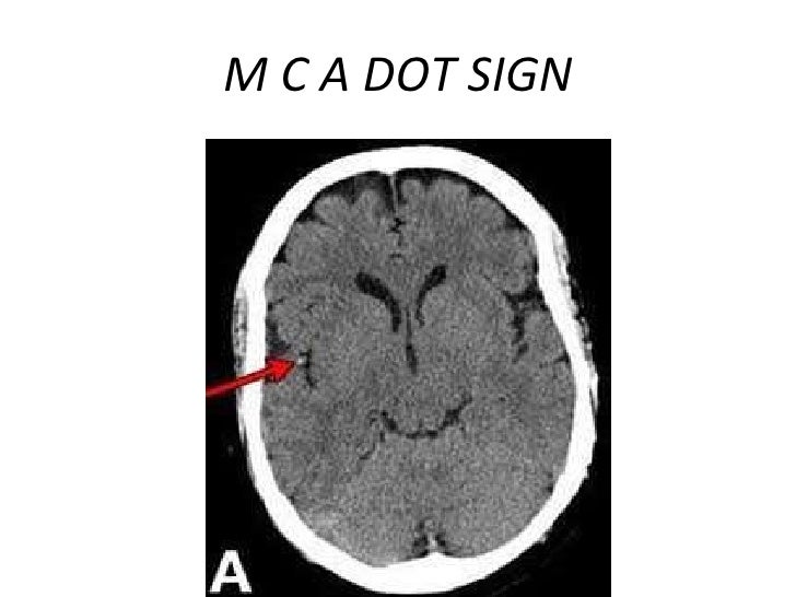 CT Scan - Basics