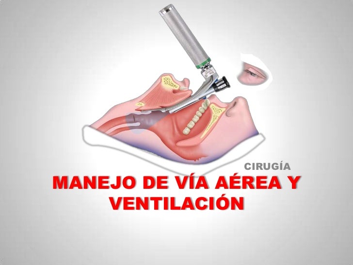 Manejo de vía aérea y ventilación