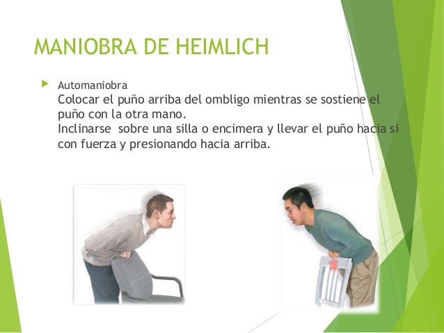 Maniobra de heimlich