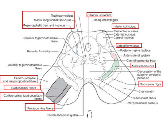 Midbrain-Neuroradiology