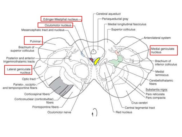 Midbrain-Neuroradiology
