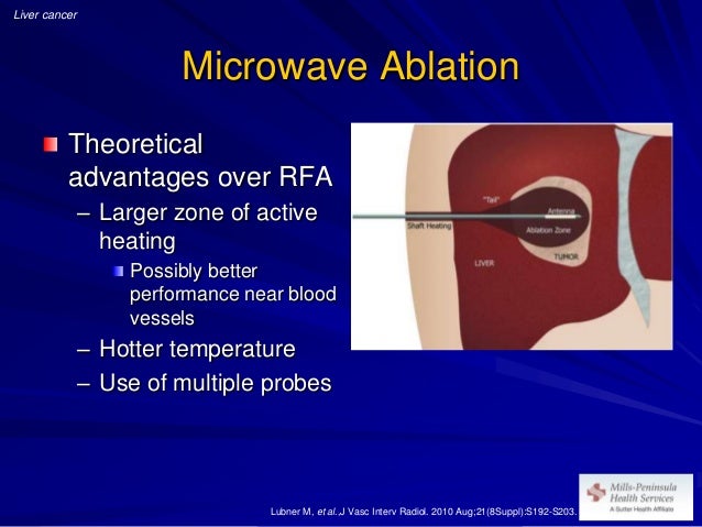 Minimally Invasive Liver Resection and Ablation For Malignancy