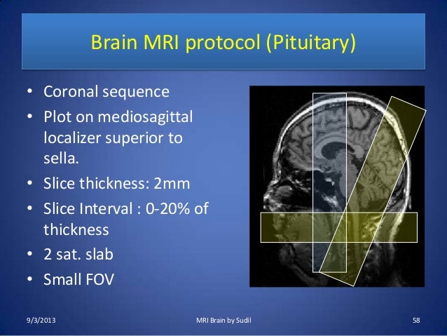 MRI Procedure of Brain
