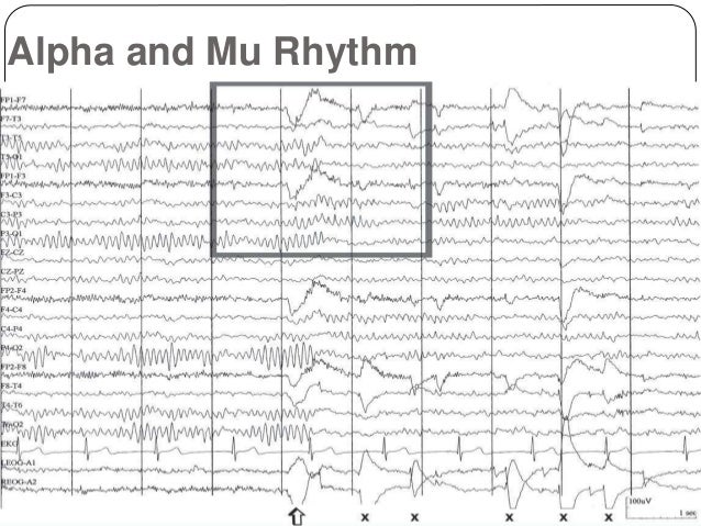 Mu rhythm