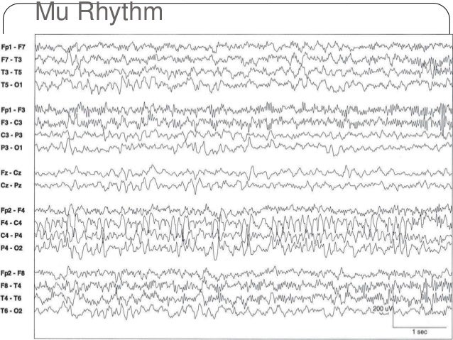 Mu rhythm