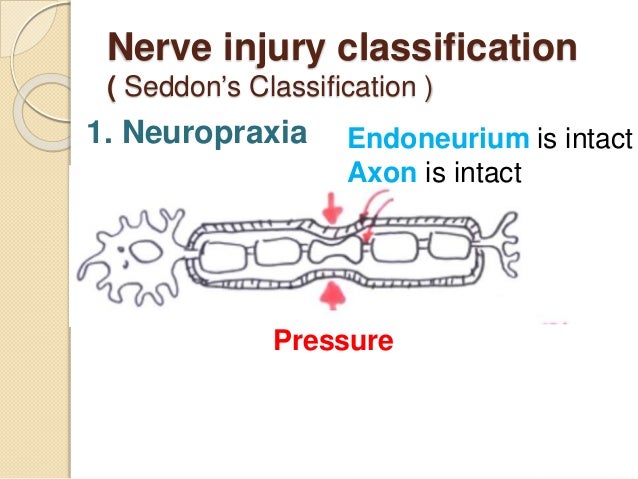 Nerve injury