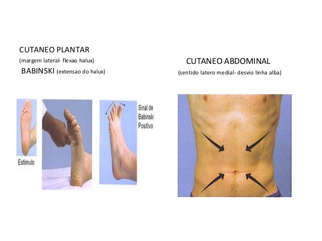 Neurologico22 04 2014