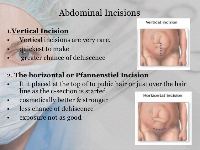 Operative Obstetrics