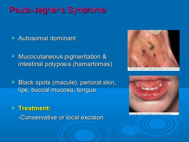 Oral Manifestations Of Systemic Diseases