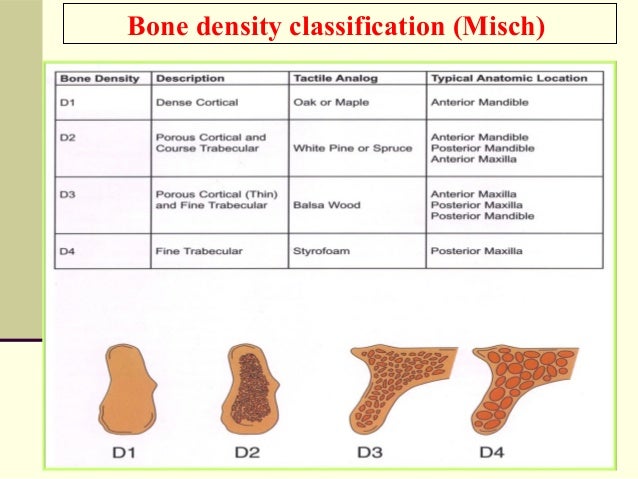 Osseointegration final