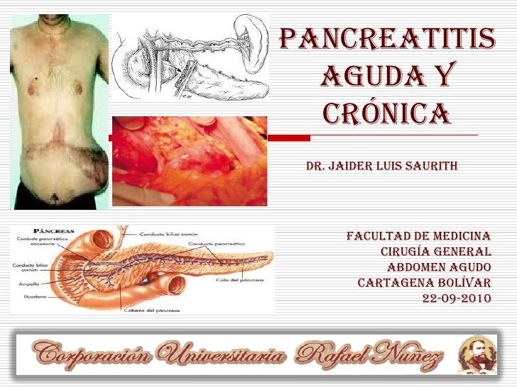 Pancreatitis aguda y cronica