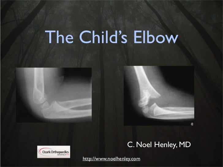 Pediatric Elbow Examination And X Rays