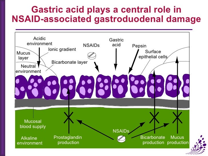 Peptic ulcer management in the era of nsaid
