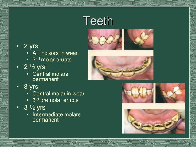 Determining Age, Height, and Weight