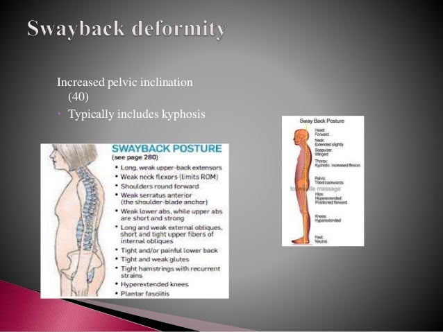 Postural Deviations