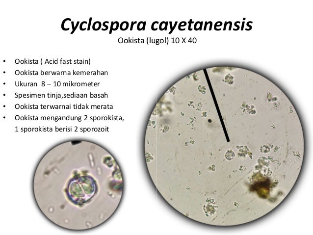 Praktikum parasitologi blok HIV/AIDS