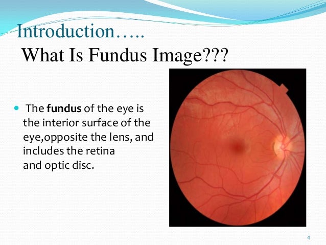 Enhancement Of Retinal Fundus Image Using 2 D Gabor Wavelet Transform