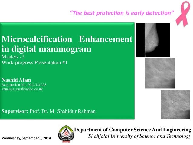 Microcalcification Enhancement In Digital Mammogram
