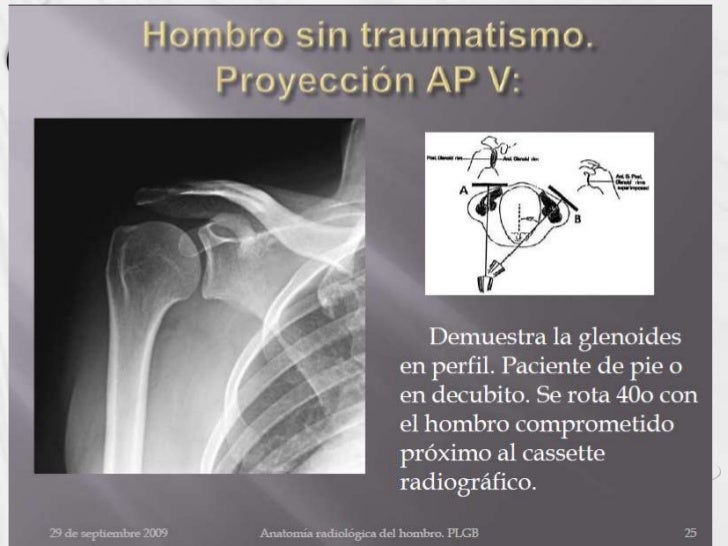 Radiología hombro