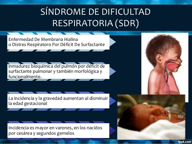 Recien nacido con dificultad respiratoria: Enfoque diagnóstico y tera…