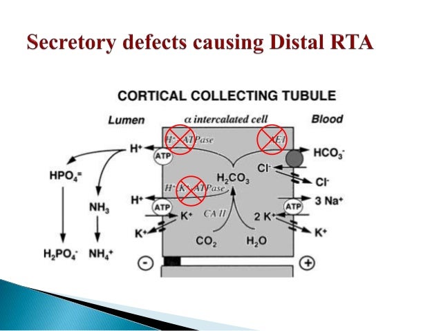Renal tubular acidosis