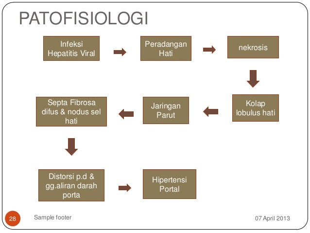 Responsi sirosis hati rkg