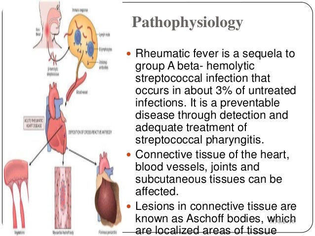 Rheumatic fever