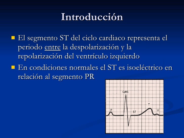 Elevación del Segmento ST