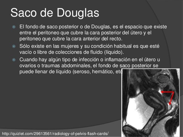 Semiologia de tc y rm abdomen