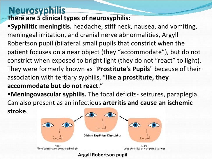 Short presentation version cns infections Lecture