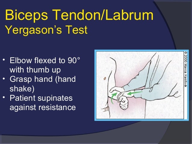 Yergason Test Bicep Tendonitis