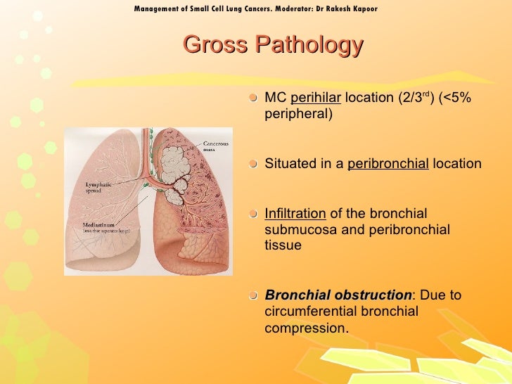 Small Cell Carcinoma Of Lung