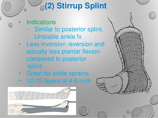 Splint ppt by rupeshkumar