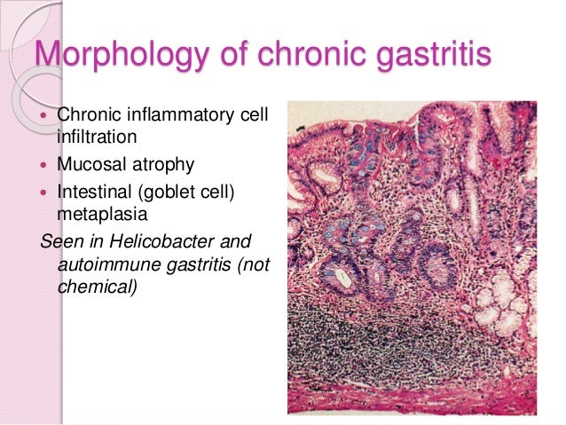 Stomach pathology lecture